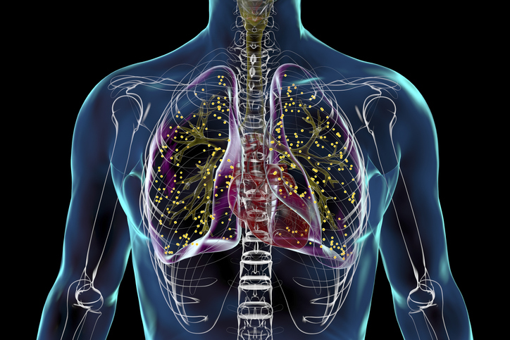 TB Center for Specialized Pulmonary Services - Florida Department of ...